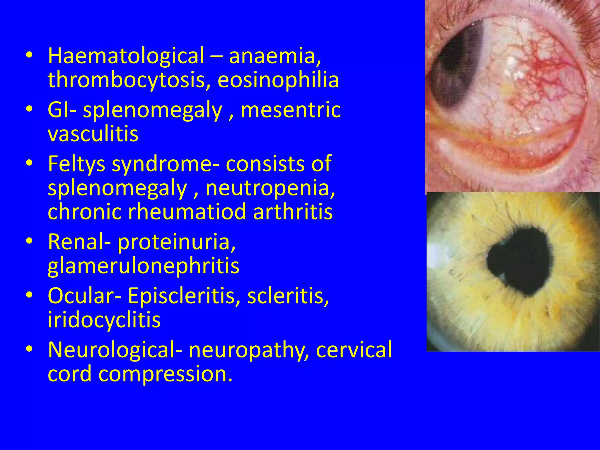 Introduction ,pathogenesis , clinical manifestations of rheumatoid | PPTX