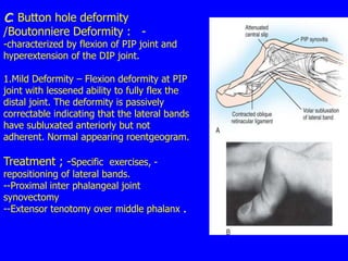 Introduction ,pathogenesis , clinical manifestations of rheumatoid | PPTX