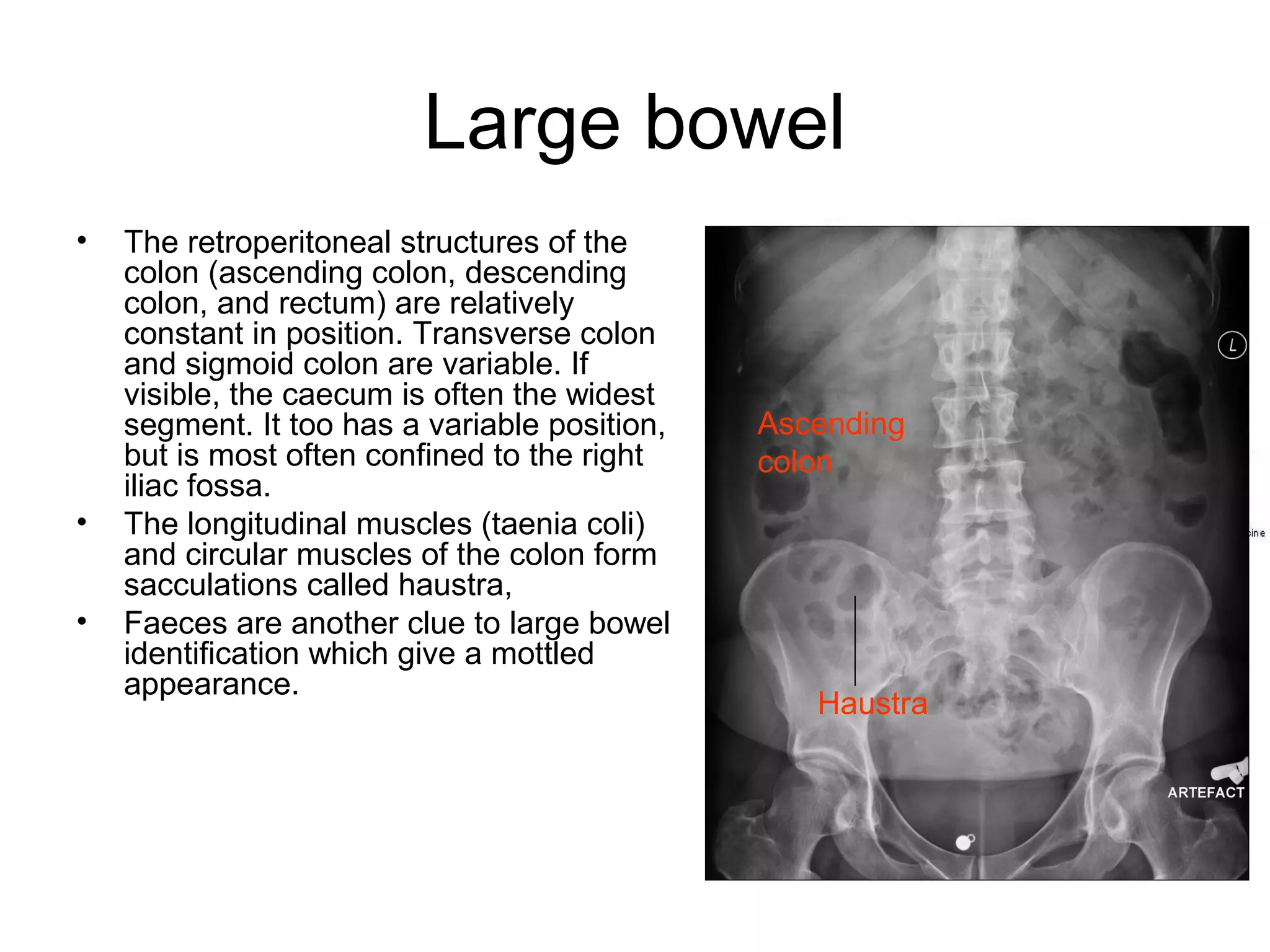 Introduction to abdominal x ray interpretation | PPT