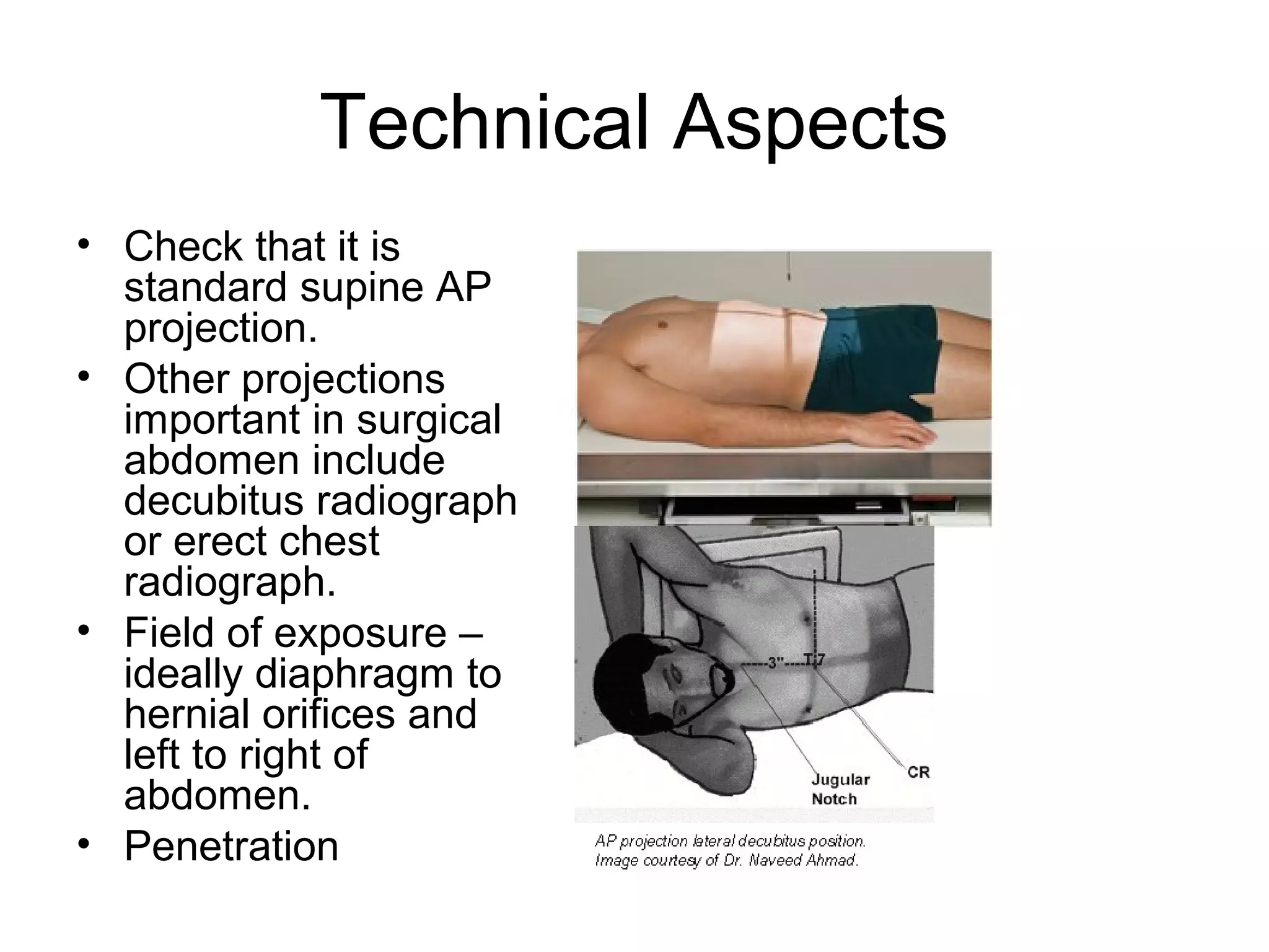 Introduction to abdominal x ray interpretation | PPT