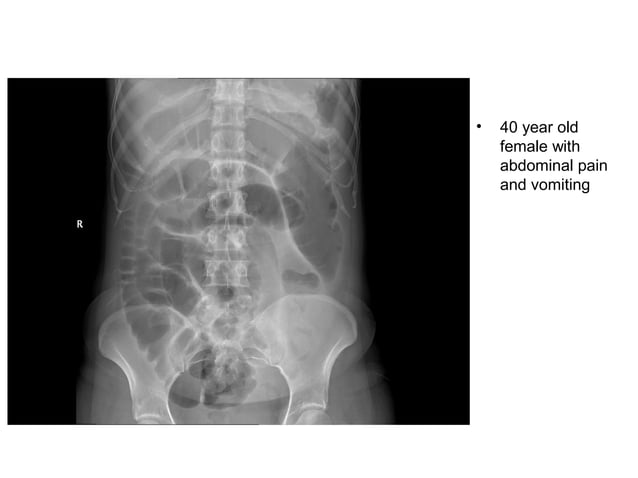 Introduction to abdominal x ray interpretation | PPT