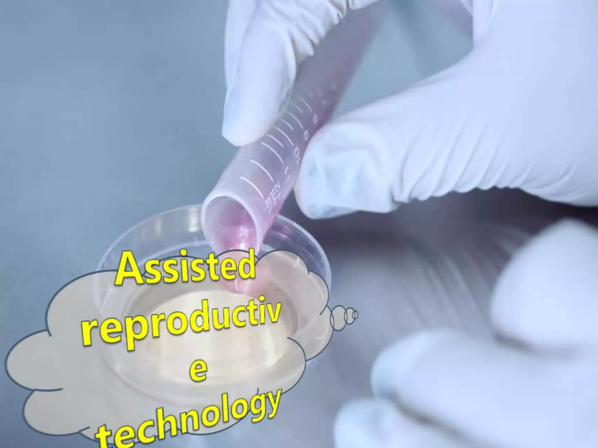Introduction to Assisted reproductive technology.pptx