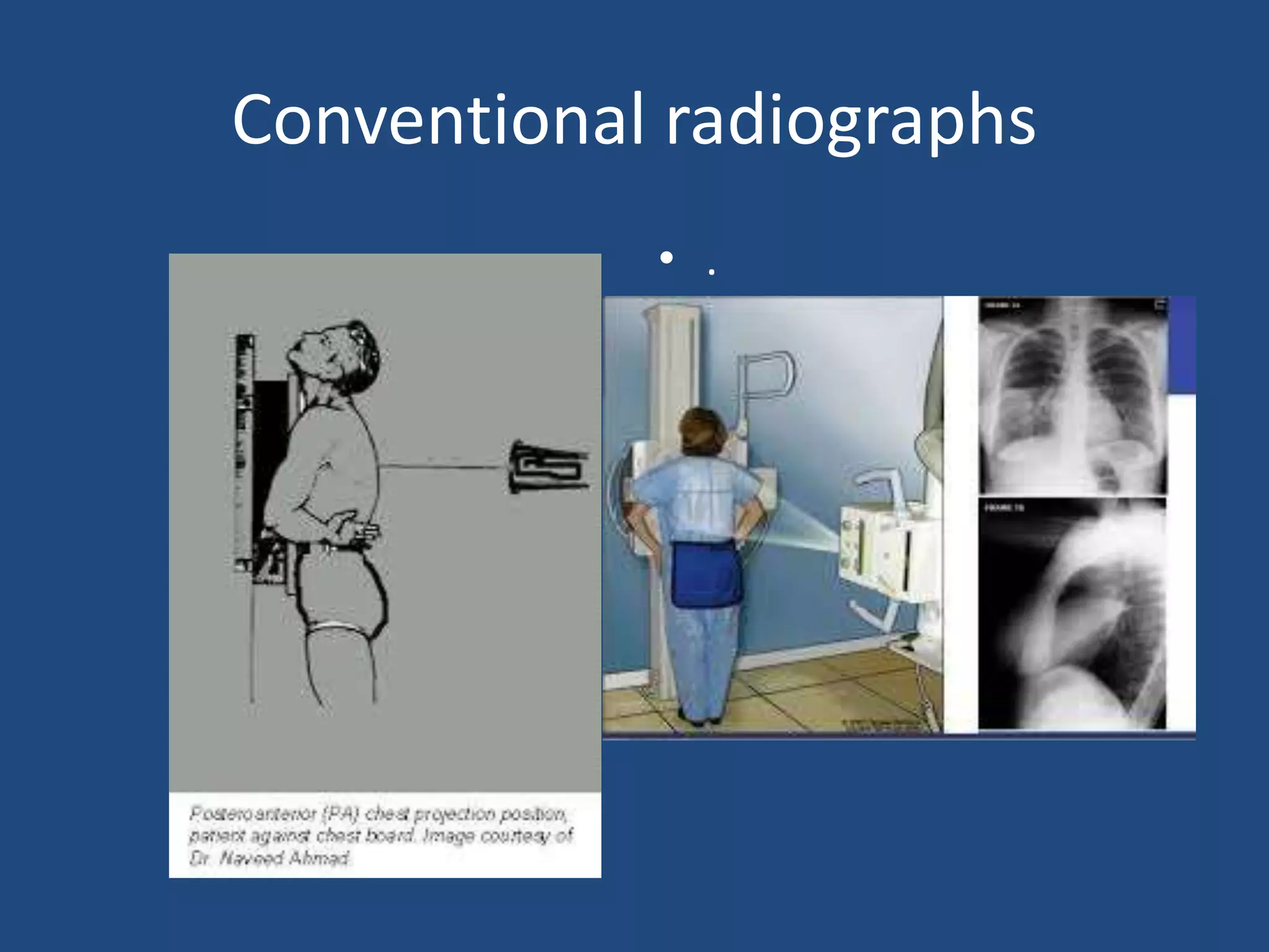 Introduction to basics of radiology | PPTX