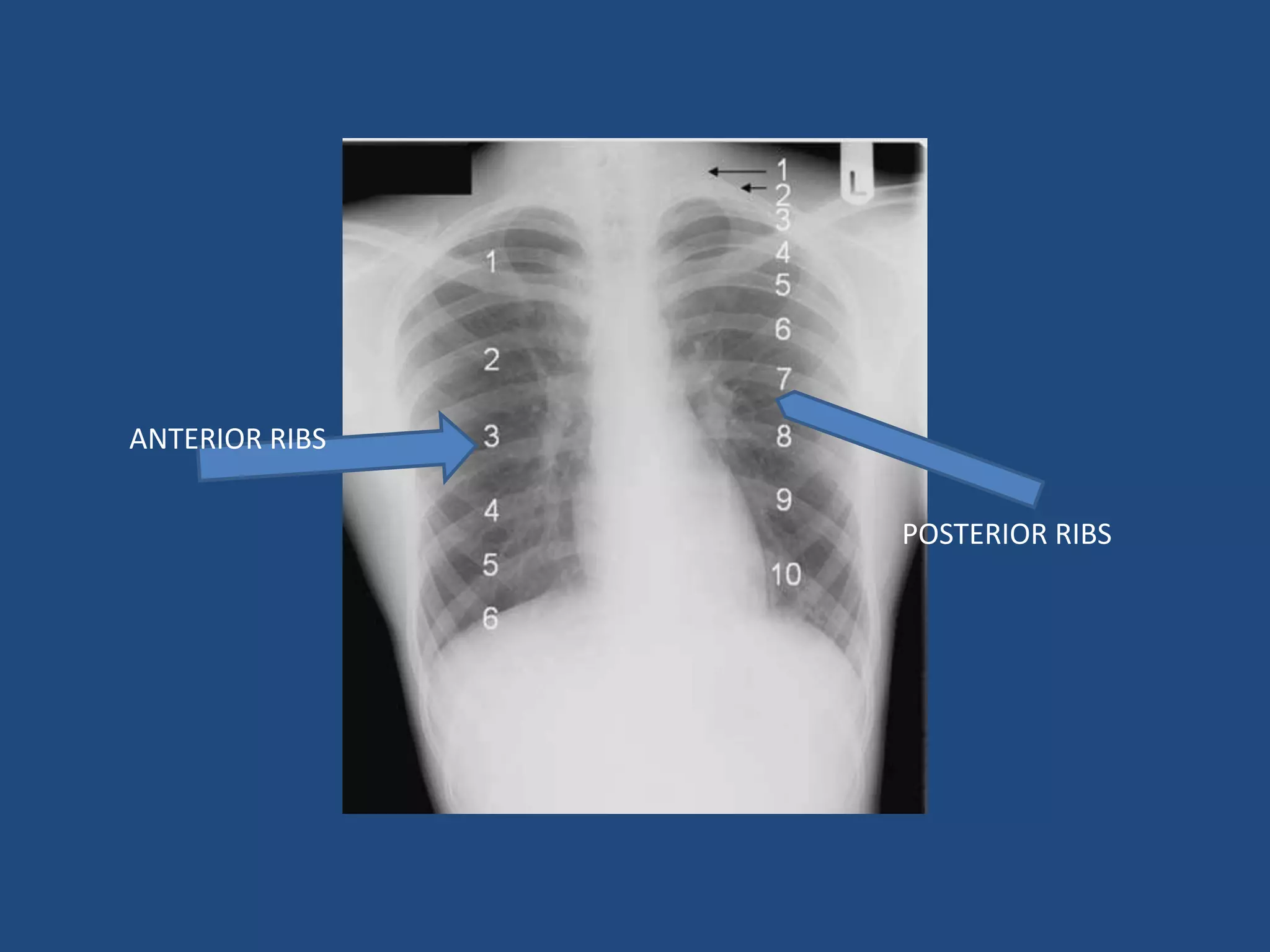 Introduction to basics of radiology | PPTX