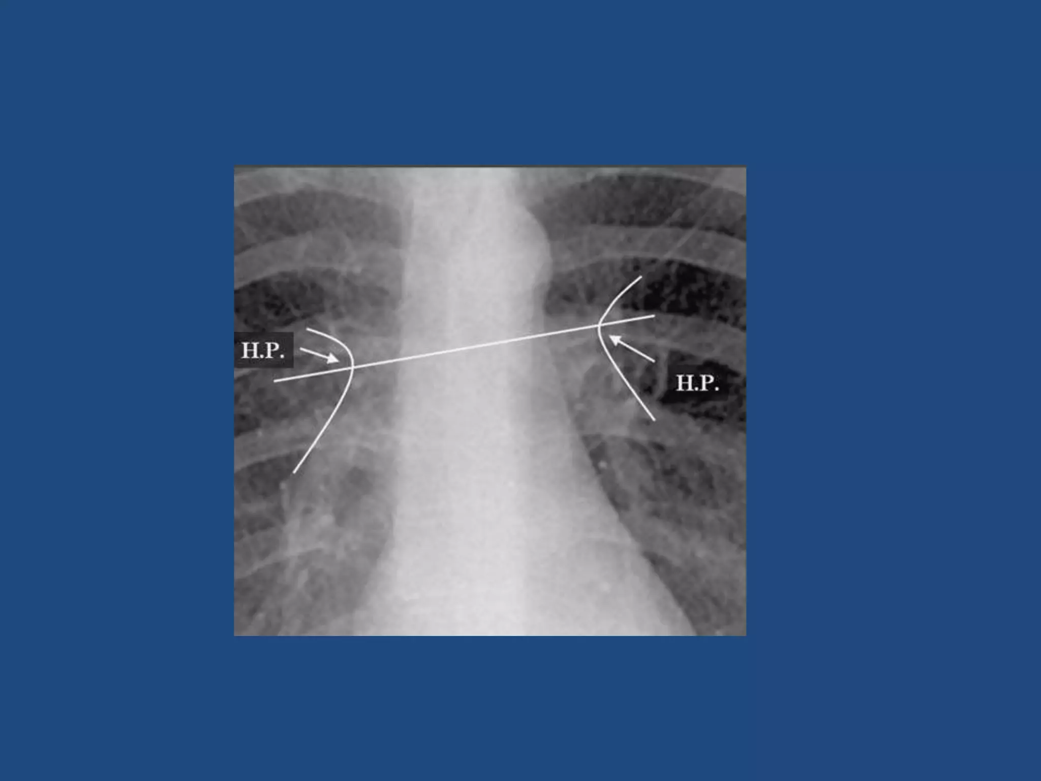Introduction to basics of radiology | PPTX
