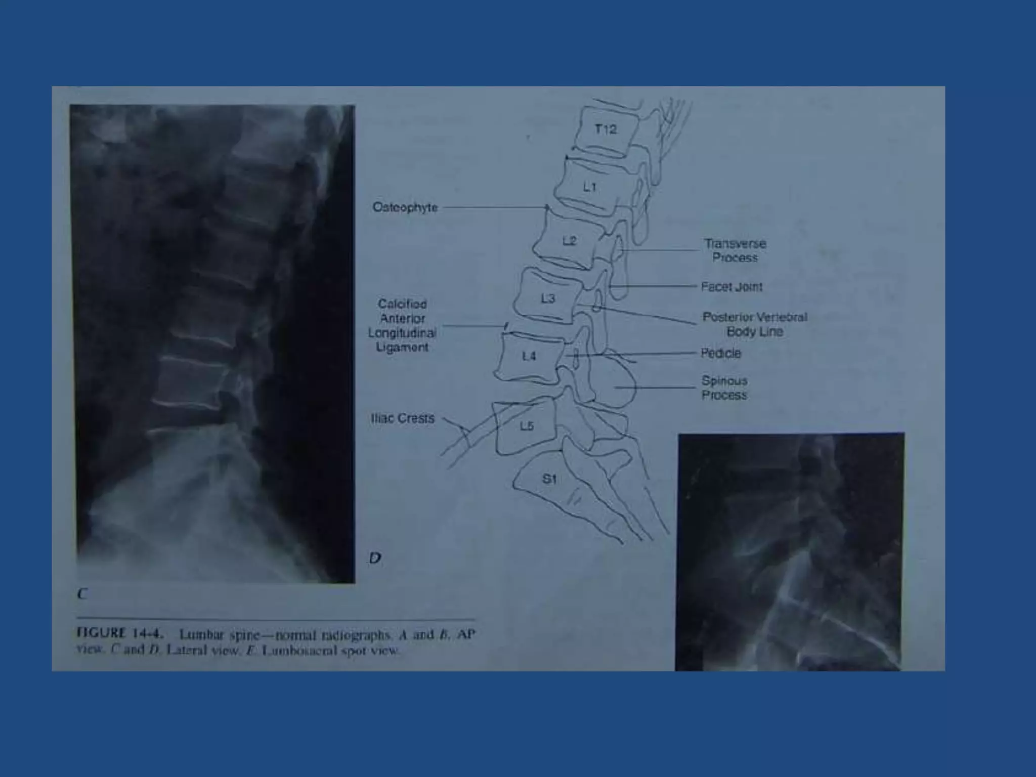 Introduction to basics of radiology | PPTX