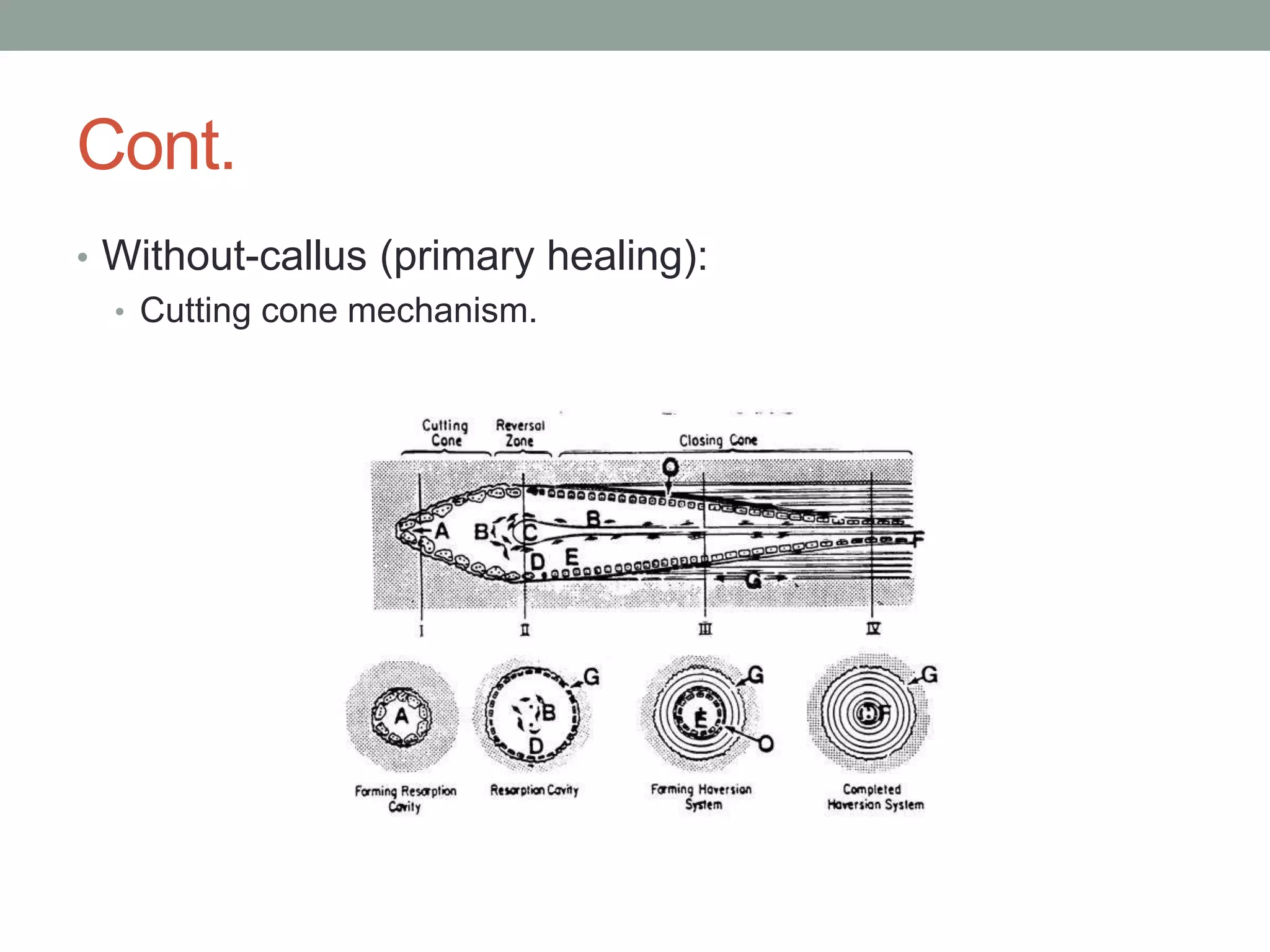 Introduction to bone fracture | PPTX