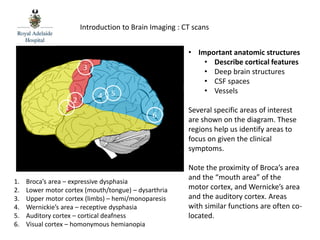 RAH Med 4 MHU - Brain CT 1 | PPT
