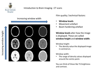 RAH Med 4 MHU - Brain CT 1 | PPT