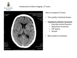 RAH Med 4 MHU - Brain CT 1 | PPT