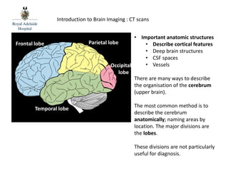 RAH Med 4 MHU - Brain CT 1 | PPT