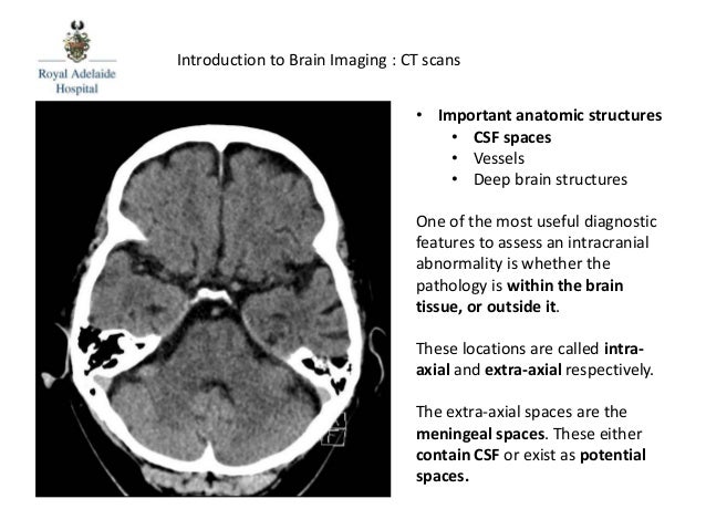 RAH Med 4 MHU - Brain CT 2