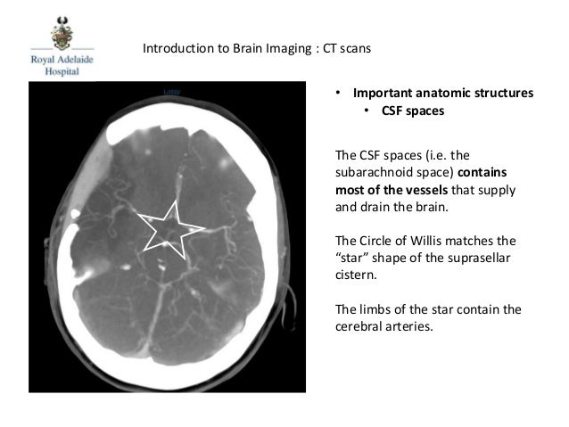 RAH Med 4 MHU - Brain CT 2