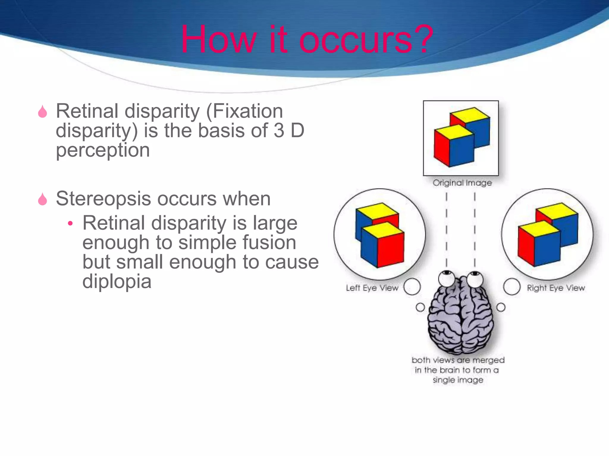 Introduction to binocular single vision (BSV) | PPTX