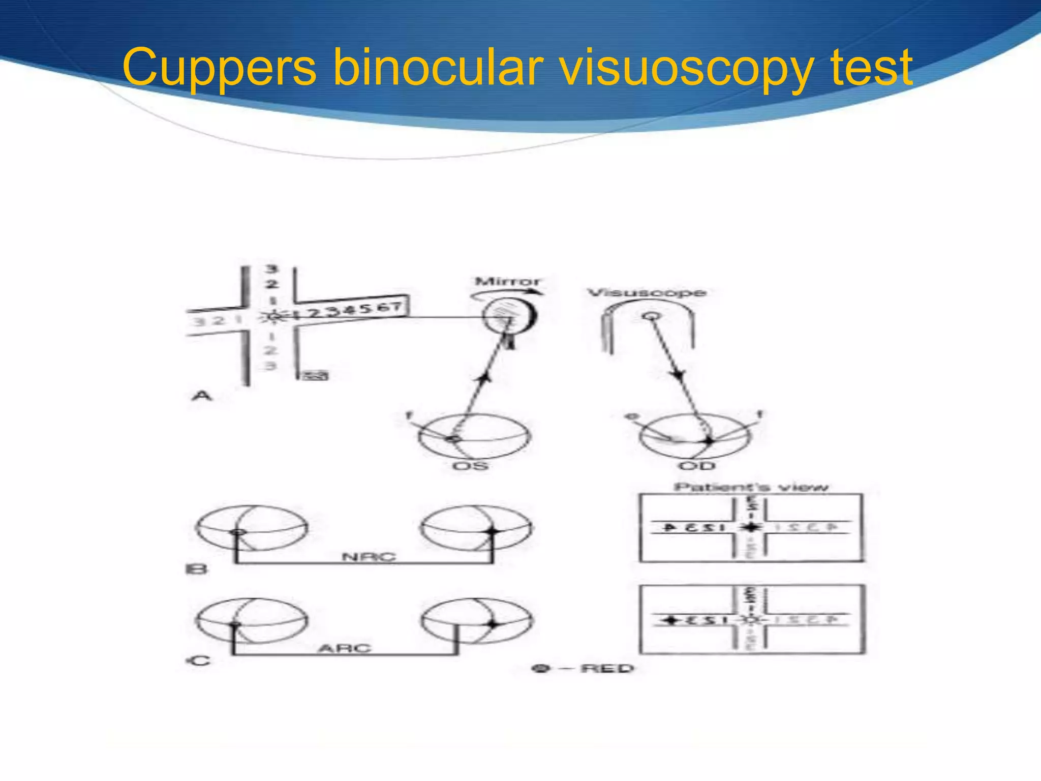 Introduction to binocular single vision (BSV) | PPTX