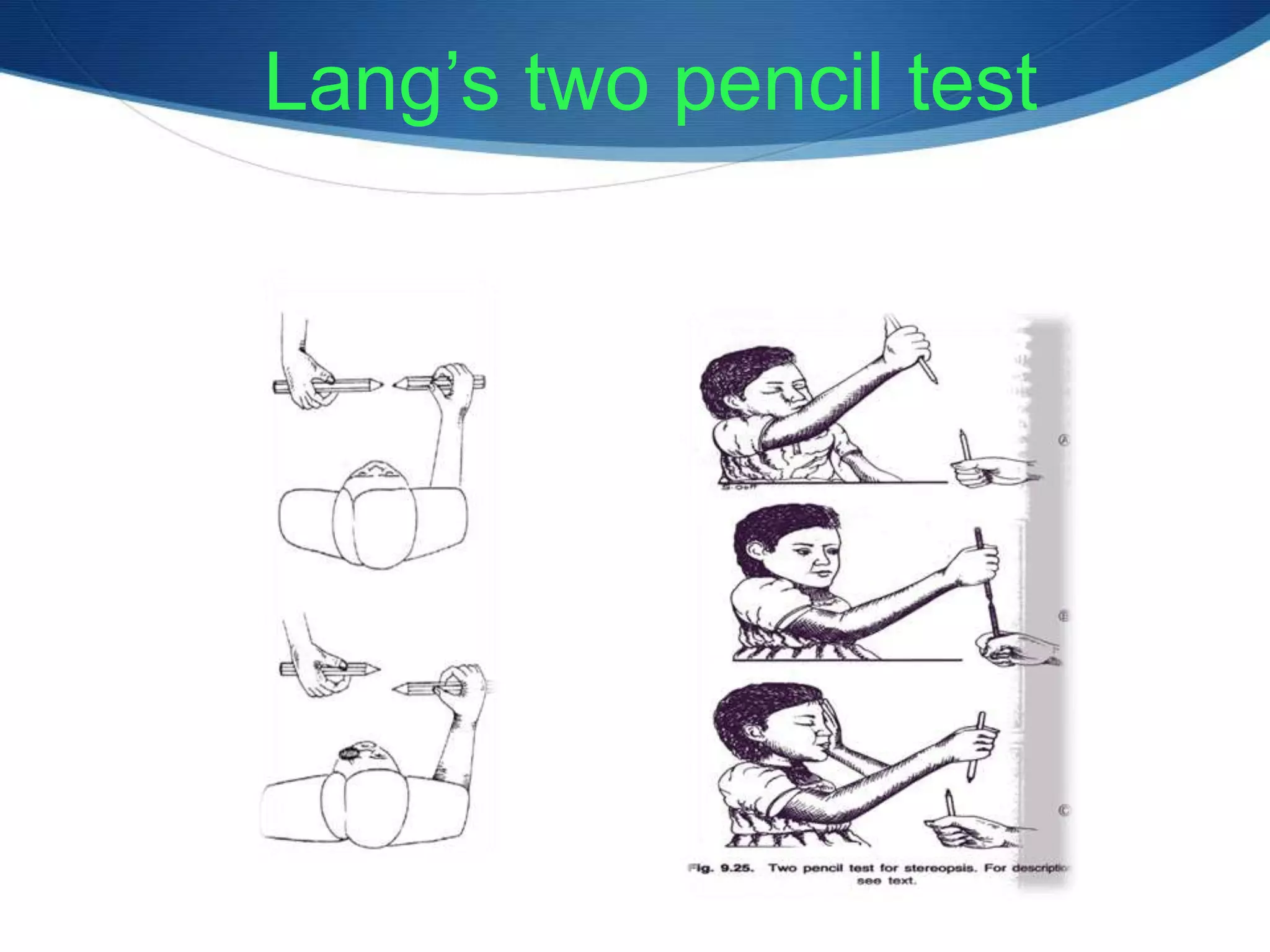 Introduction to binocular single vision (BSV) | PPTX