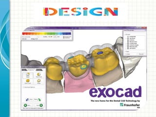 Introduction to cad cam | PPT