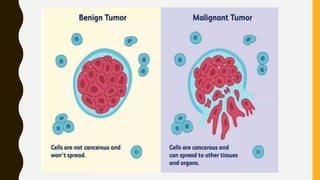 Introduction to cancer.pptxfor nursing students | PPTX