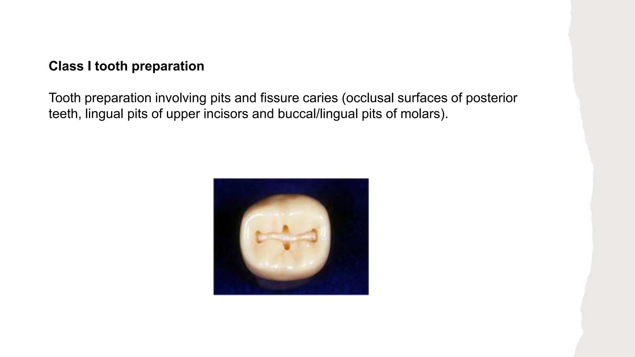 Introduction to cavity preparation and materials.pptx