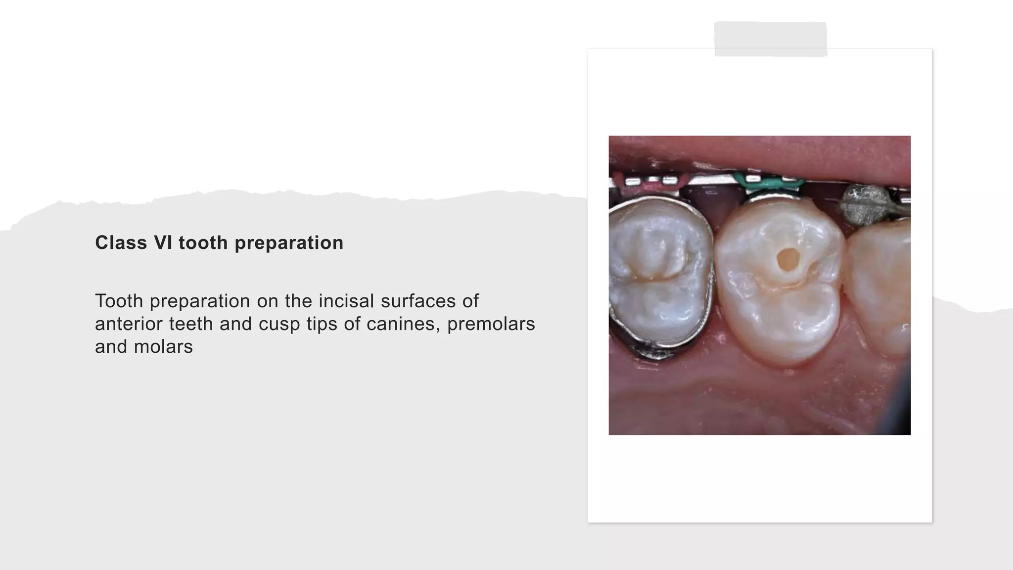 Introduction to cavity preparation and materials.pptx