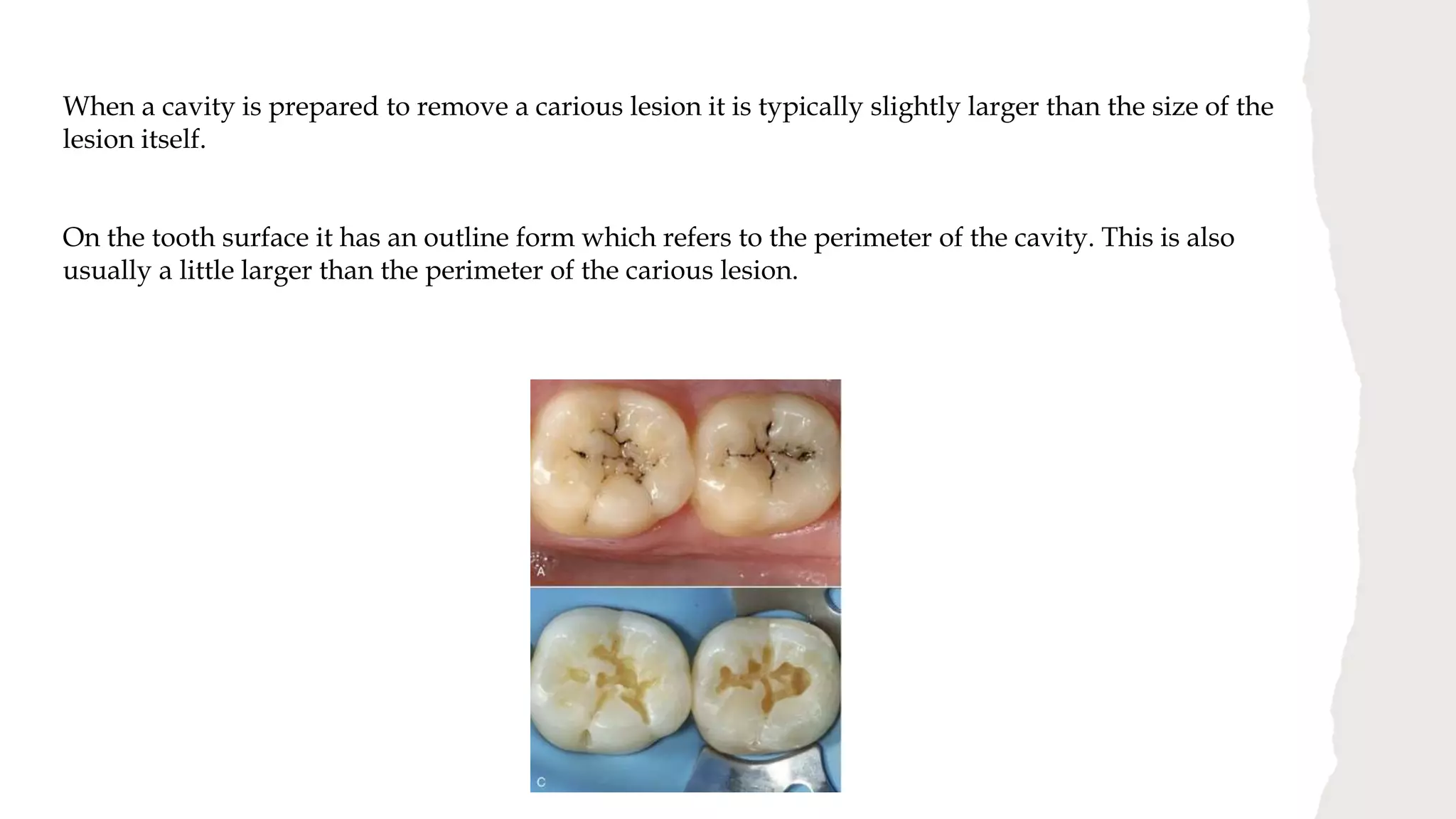 Introduction to cavity preparation and materials.pptx