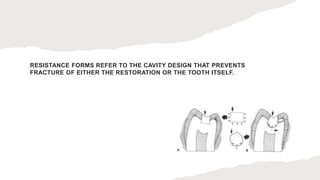 Introduction to cavity preparation and materials.pptx
