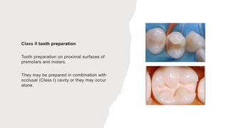 Introduction to cavity preparation and materials.pptx