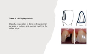 Introduction to cavity preparation and materials.pptx