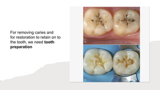 Introduction to cavity preparation and materials.pptx