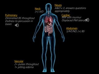 Introduction to Chest X-Ray Interpretation | PPTX