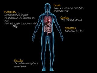 Introduction to Chest X-Ray Interpretation | PPTX