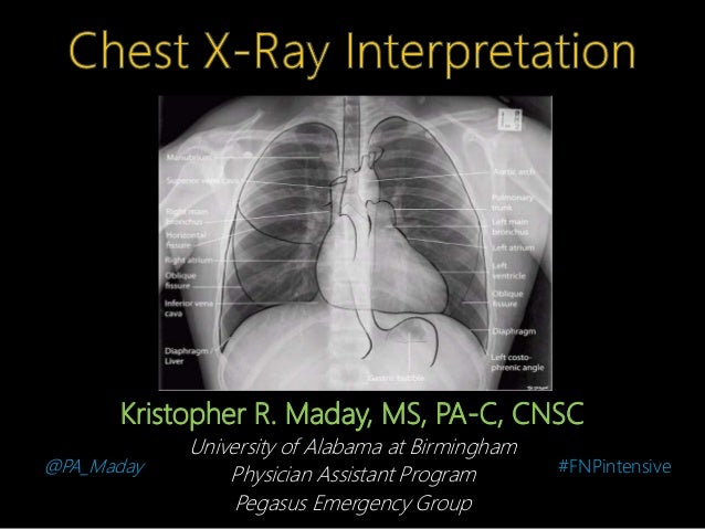 How To Interpret A Chest Xray Lesson 5 Cardiac
