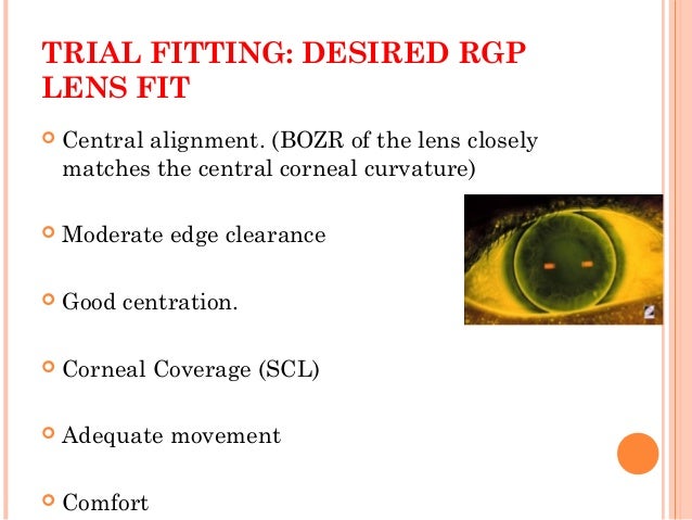 Introduction to cl fitting