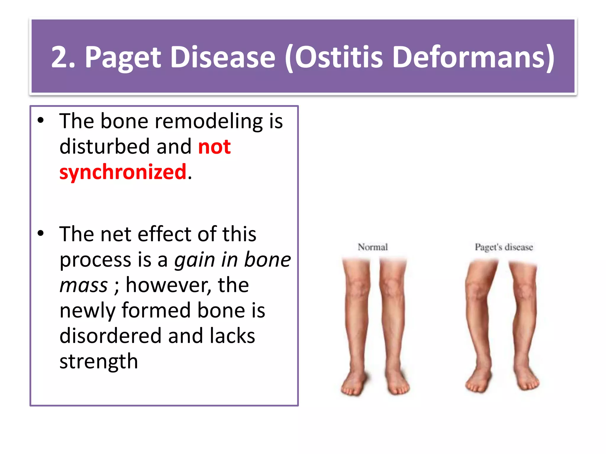 Introduction to Common Bone Disorders | PPTX