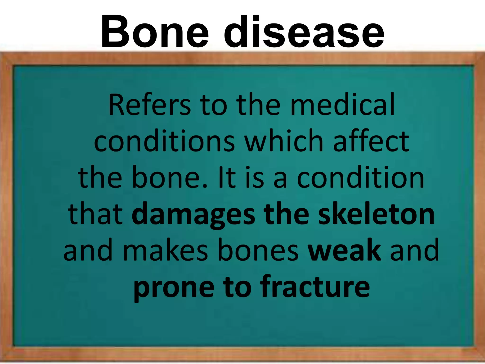 Introduction to Common Bone Disorders | PPTX