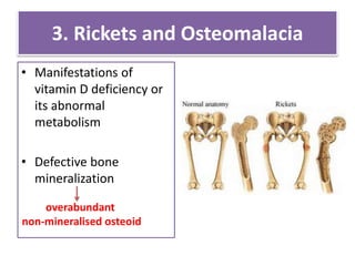 Introduction to Common Bone Disorders | PPTX