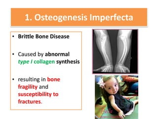 Introduction to Common Bone Disorders | PPTX