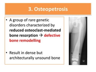 Introduction to Common Bone Disorders | PPTX