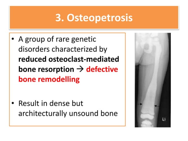 Introduction to Common Bone Disorders | PPTX | Bone and Joint ...