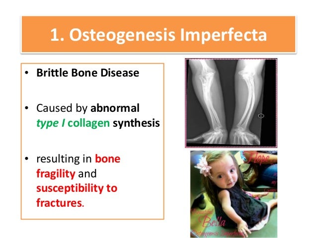 Introduction to Common Bone Disorders