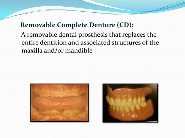 Introduction to complete_denture | PPTX