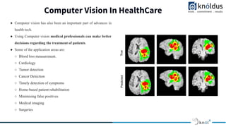 Introduction to Computer Vision.pdf
