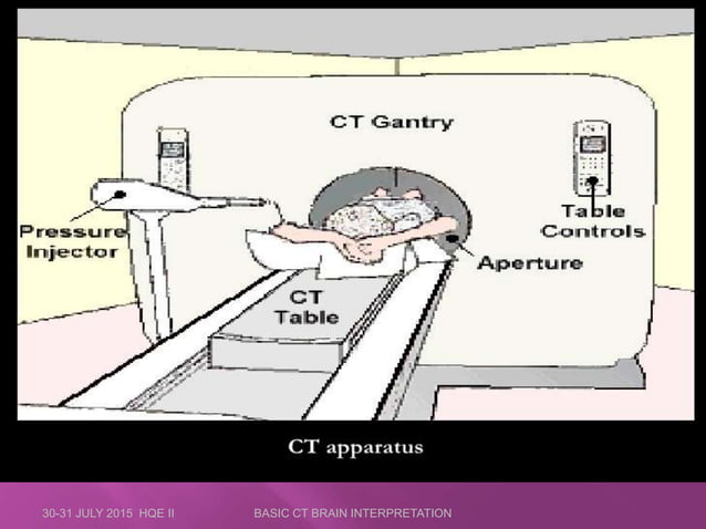 Introduction to CT Brain: The Basic Principles | PPTX | Brain and ...
