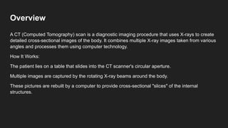 Introduction to CT Scan or Computed Tomography | PPTX