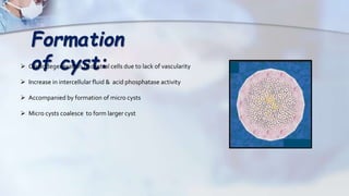 Introduction to oral and maxillofacial cyst | PPTX