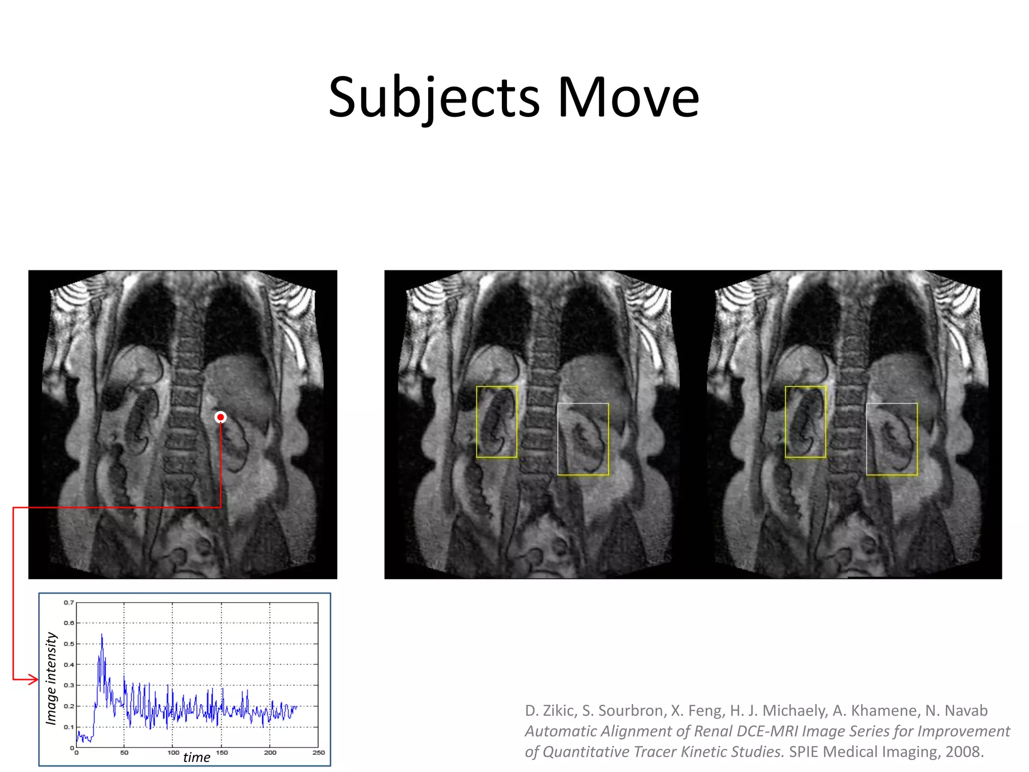 Introduction To Deformable Registration Pdf