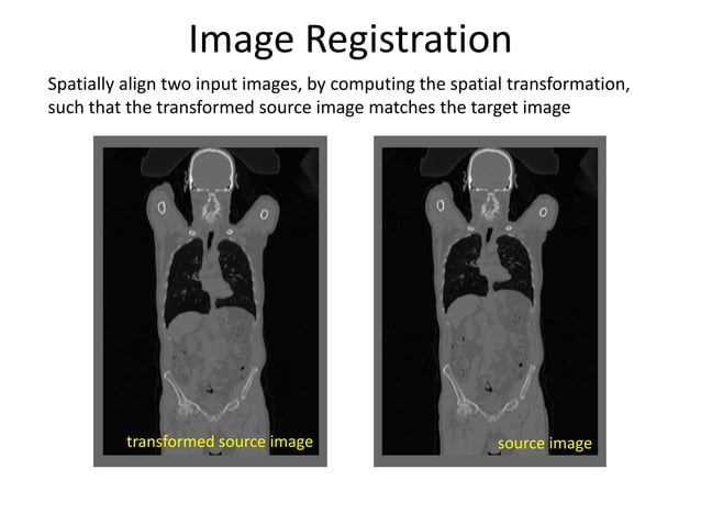 Introduction to Deformable Registration.pdf