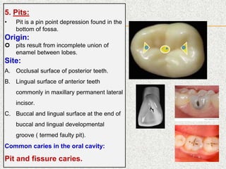 Introduction to dental anatomy | PPTX
