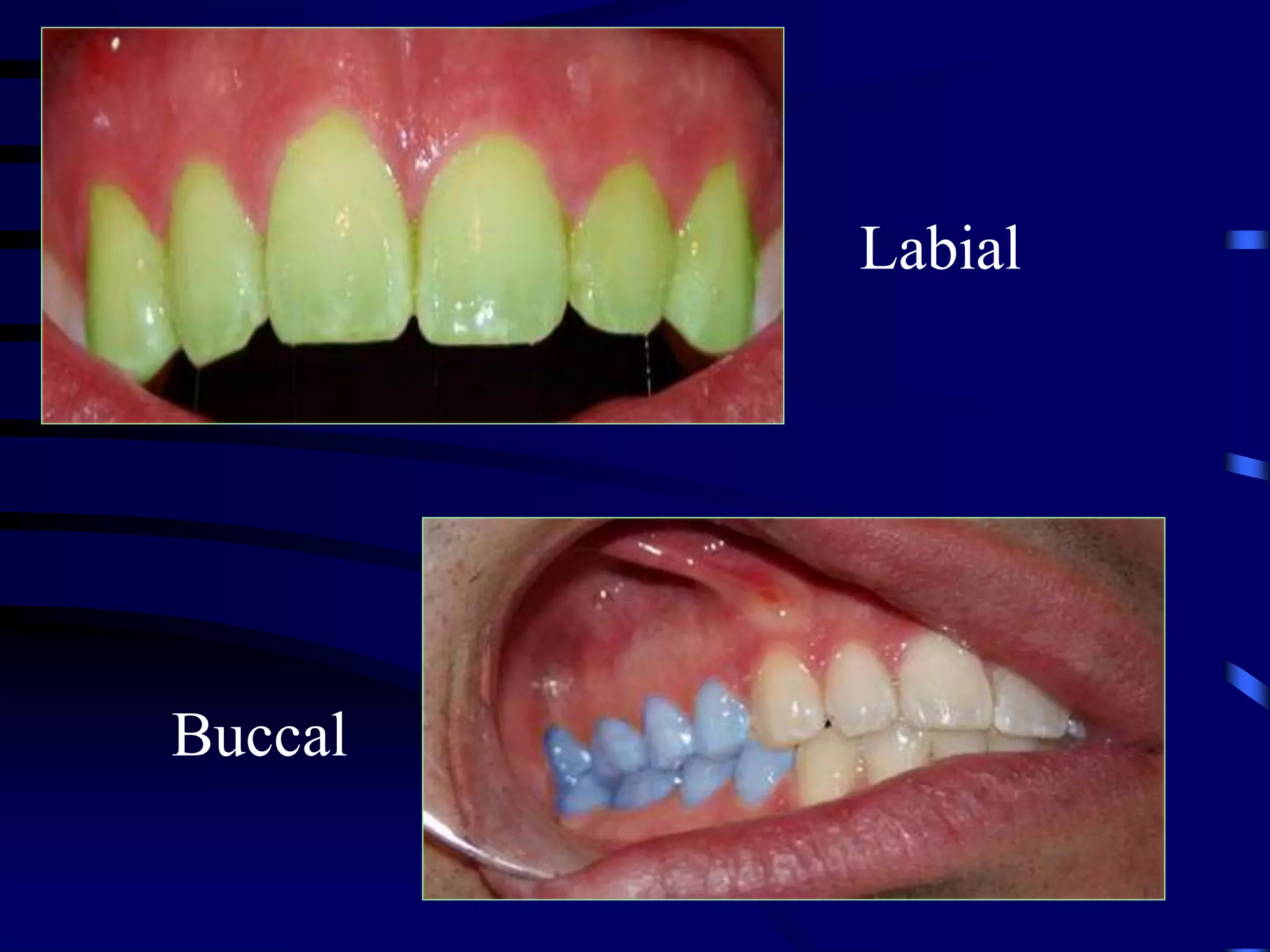 Introduction to Dental Anatomy.ppt