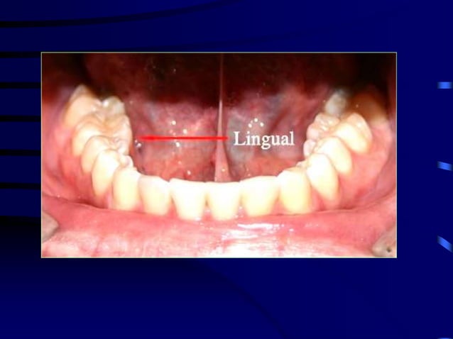 Introduction to Dental Anatomy.ppt